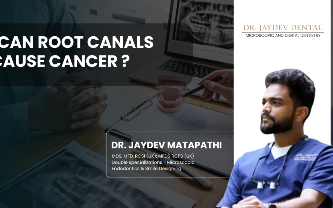 Can Root Canals Cause Cancer| Jaydev Dental Clinic